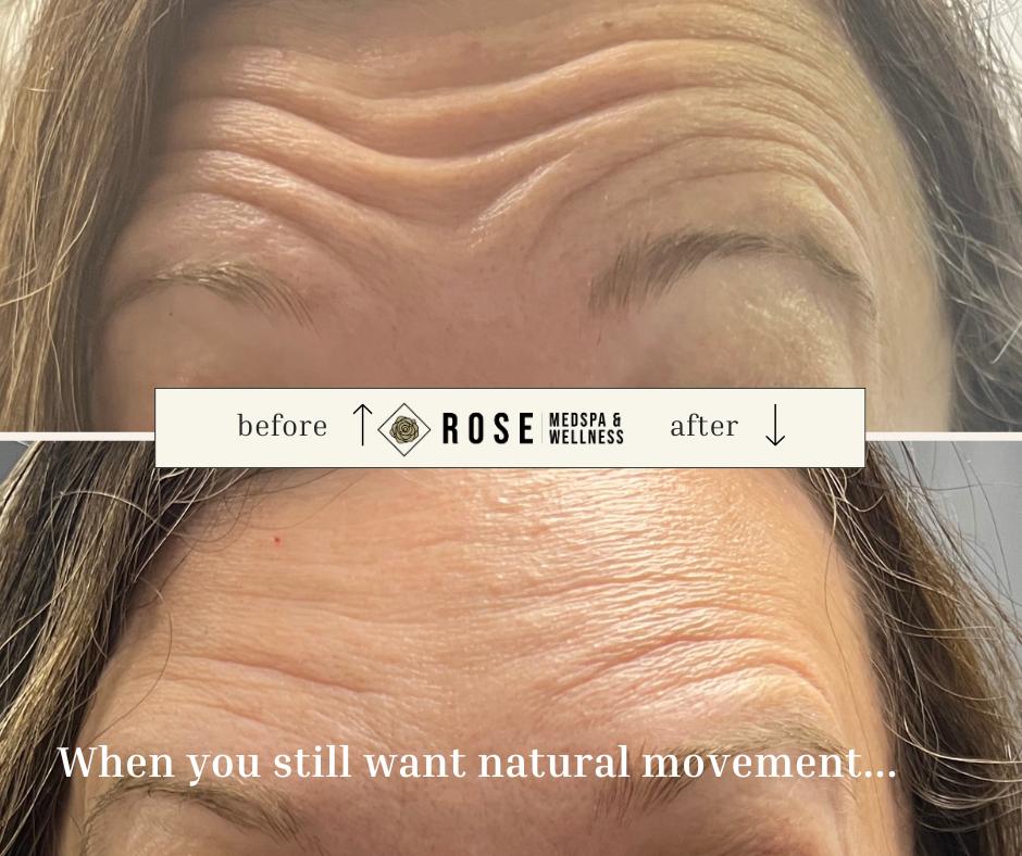 Rose MedSpa & Wellness Provides Services & Products to Restore Skin & Body